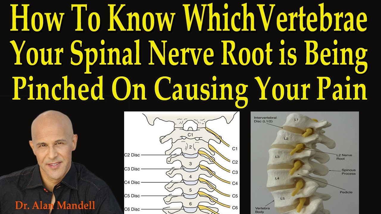 How to Know Which Vertebrae Your Spinal Nerve Root is Being Pinched On ...