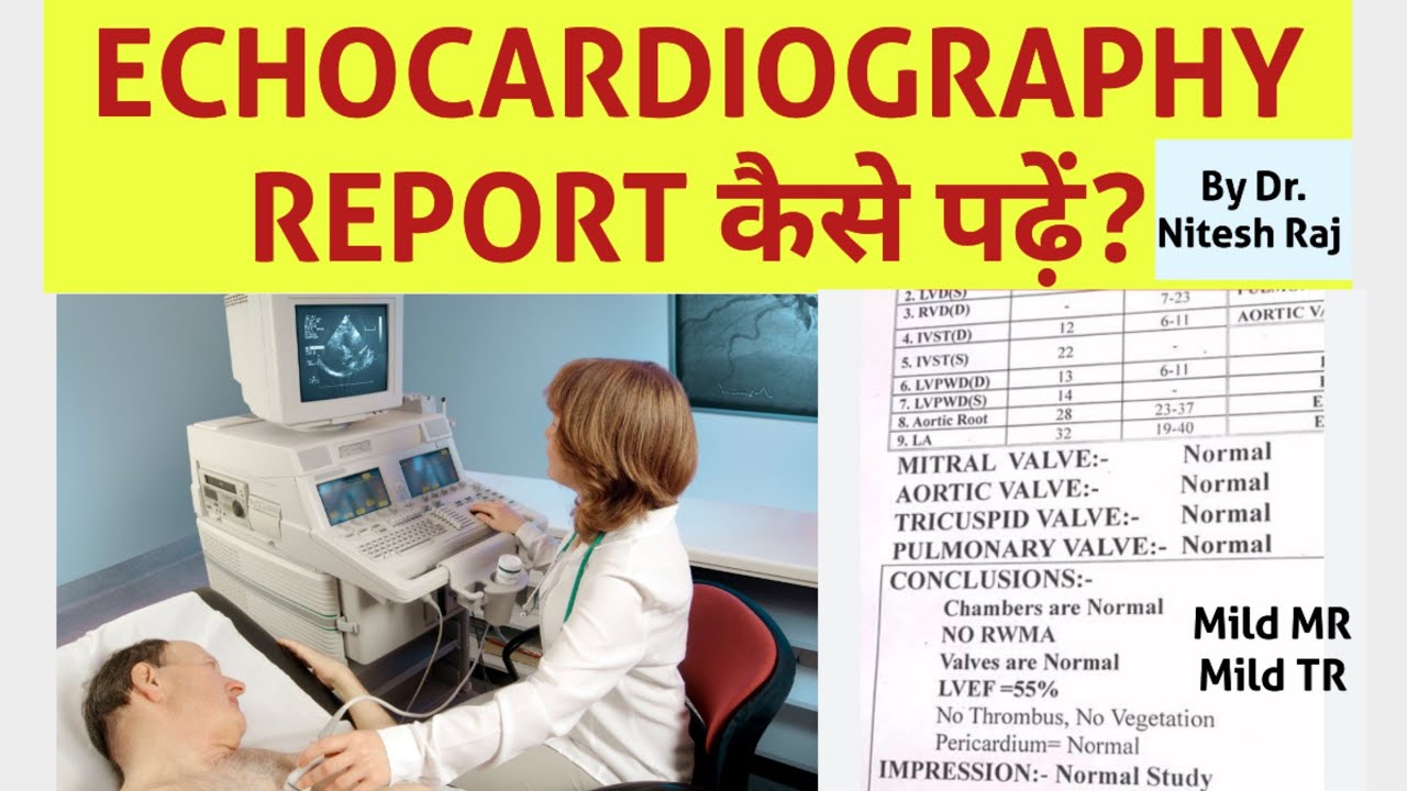Echo report kaise padhe #drniteshraj HINDI mild MR,mild TR,EF,RWMA ...