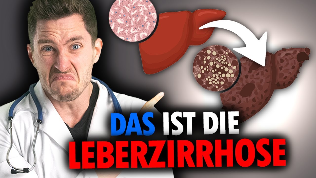 Leberzirrhose - DARUM solltest DU deine LEBER gut behandeln! - YouTube