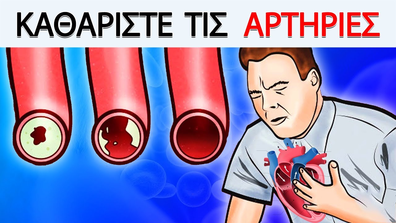 ΑΥΤΕΣ ΟΙ 8 ΤΡΟΦΕΣ ΘΑ ΣΕ ΣΩΣΟΥΝ ΑΠΟ ΚΑΡΔΙΑΓΓΕΙΑΚΑ ΠΡΟΒΛΗΜΑΤΑ - YouTube
