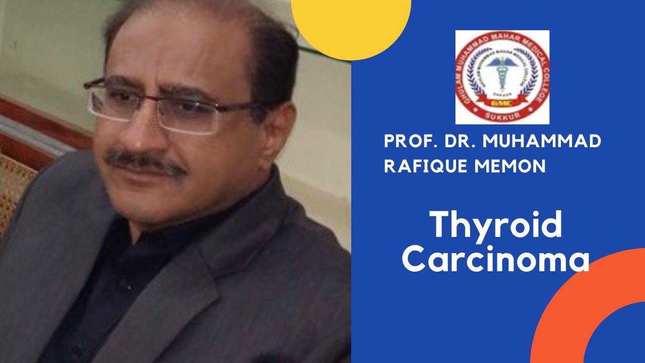 Thyroid Carcinoma | By Prof. Dr. Muhammad Rafique Memon | GMMMC Sukkur ...