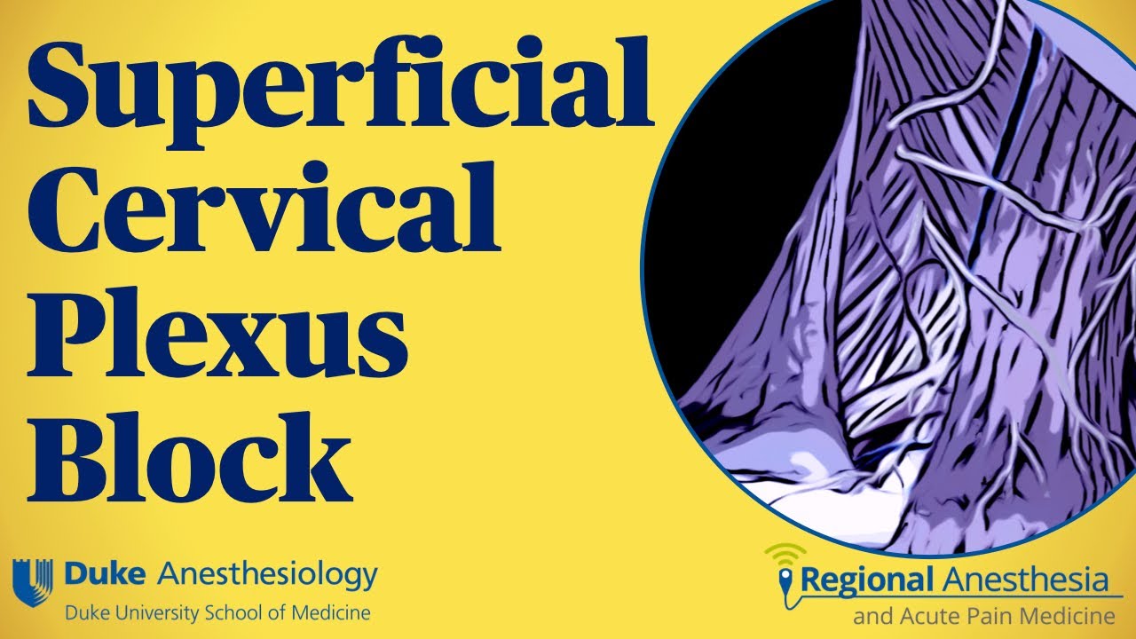 Superficial cervical plexus block - YouTube