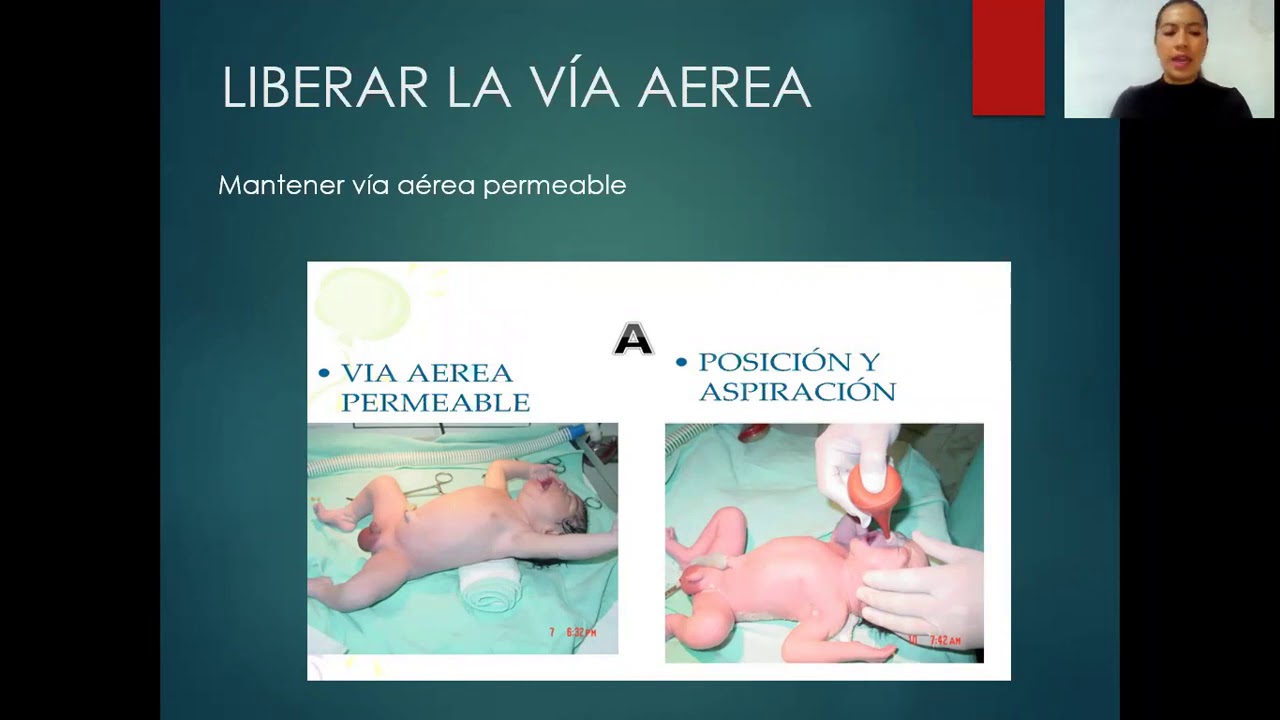 Cuidados inmediatos y mediatos del recién nacido - YouTube