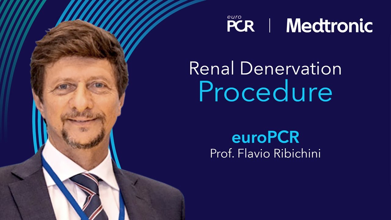 Real-world procedure experience with radiofrequency renal denervation ...