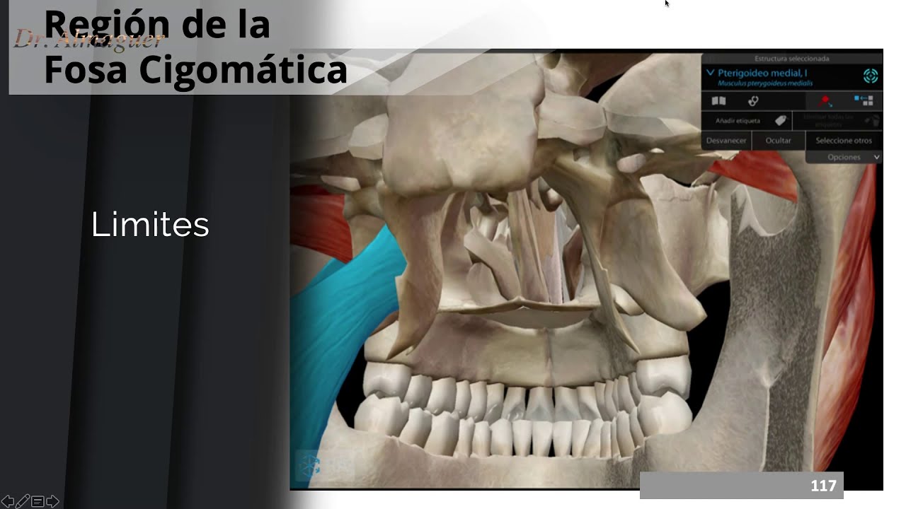 Macizo Oseo Facial, Region de la Fosa Cigomatica, Dr. Almaguer - YouTube