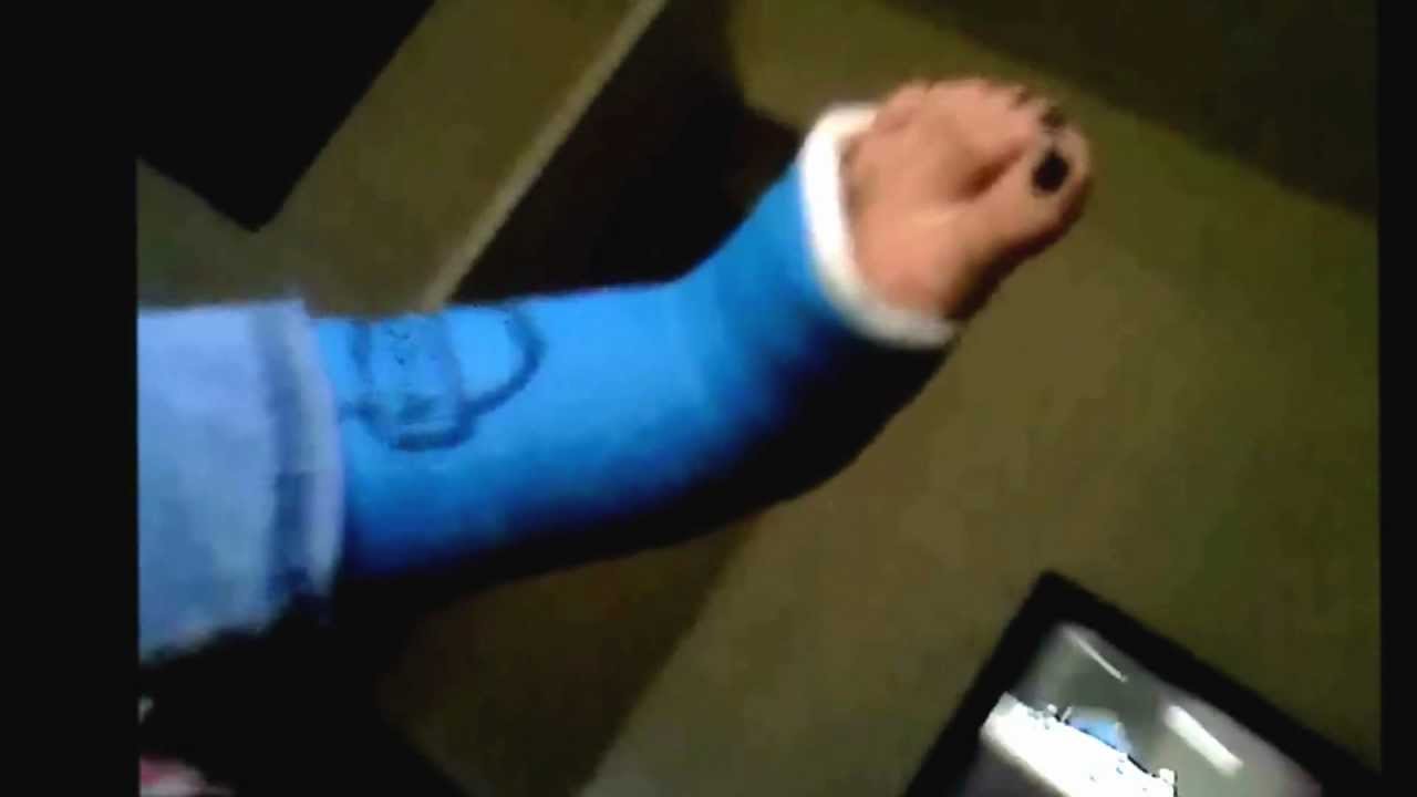 Hanging out with my Blue Cast - YouTube