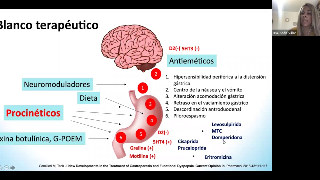Procinéticos en gastroparesia - YouTube