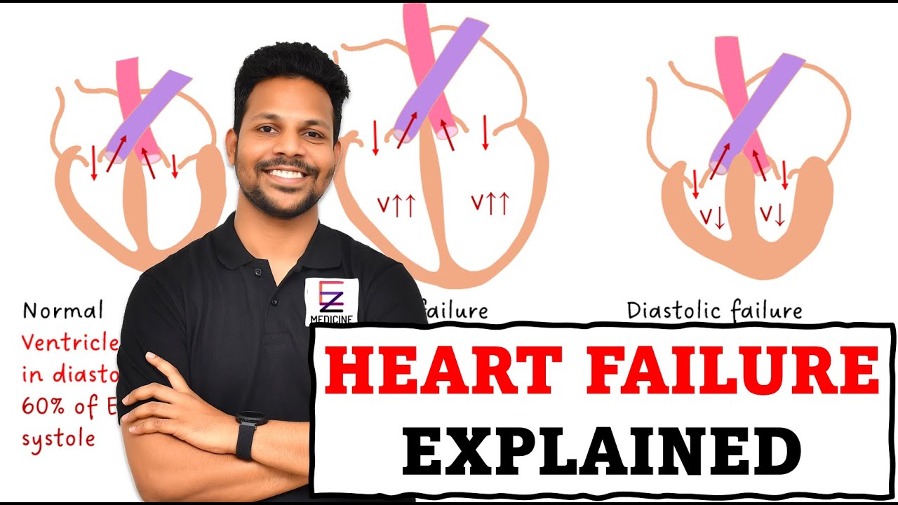 HEART FAILURE EXPLAINED - YouTube