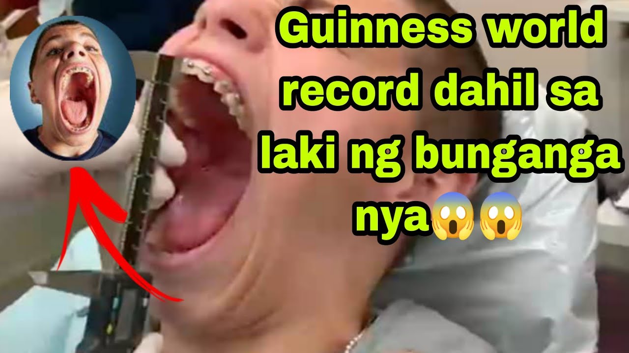 Pinaka Malaking bunganga na tao sa buong Mundo l Guinness world record ...