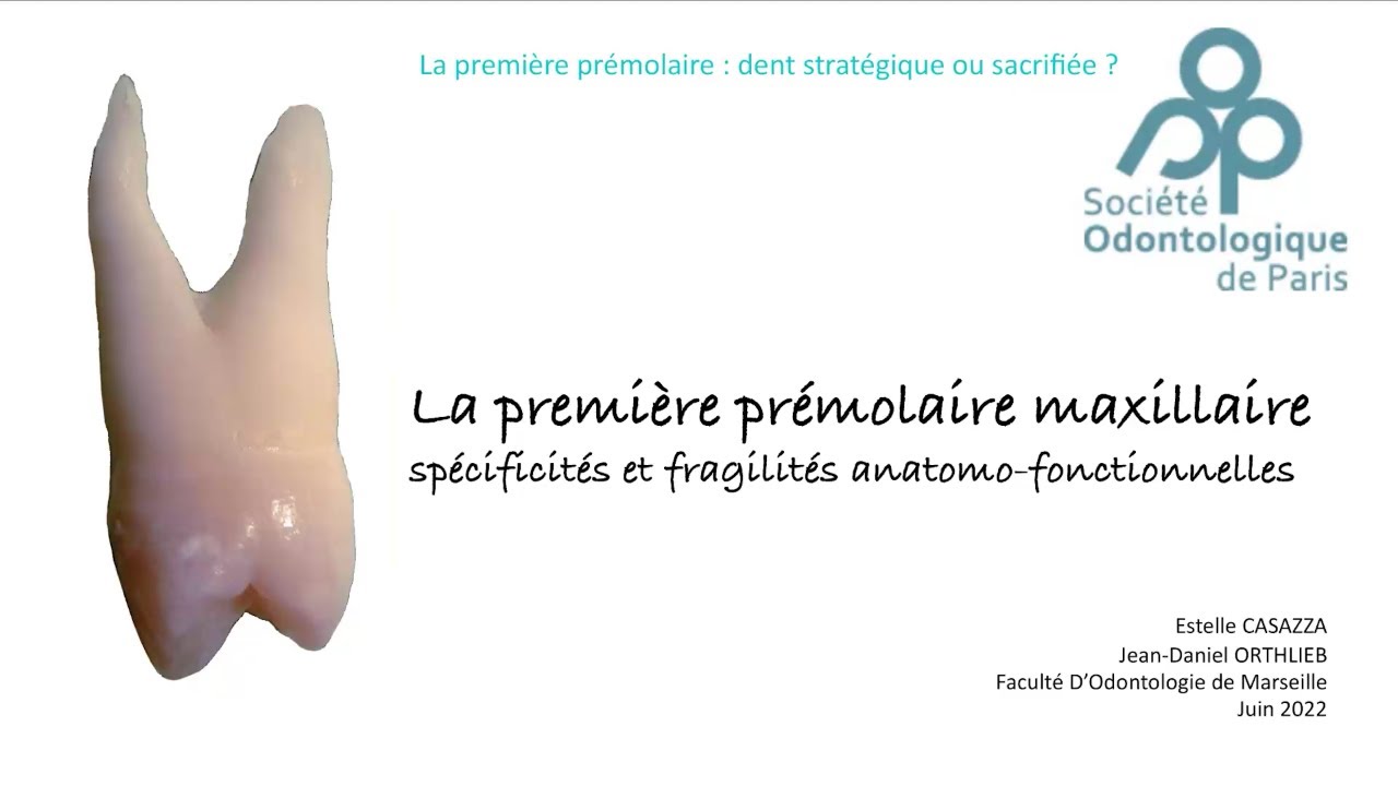 « La première prémolaire maxillaire : spécificités et fragilités ...