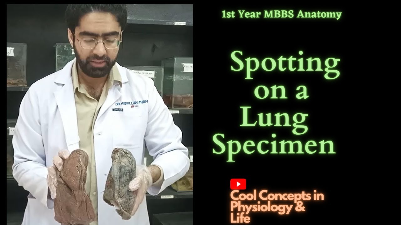 Anatomy: Spotting on a Lung specimen (1st year MBBS) - YouTube