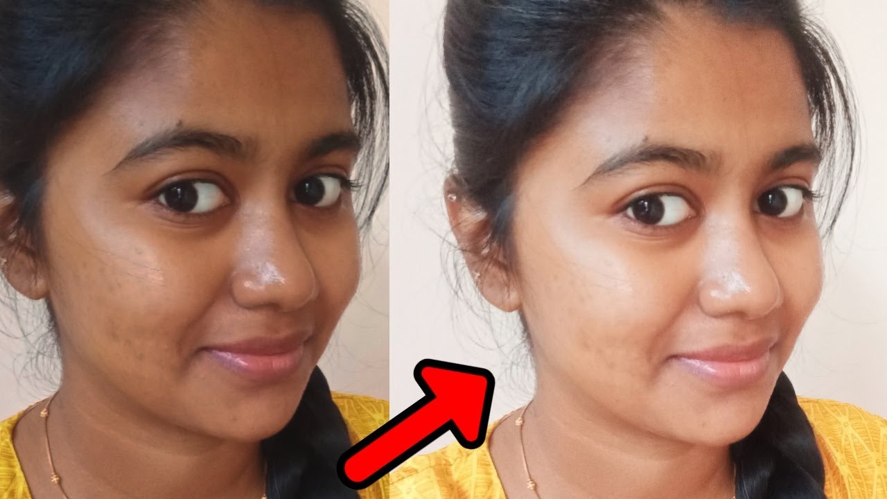 🔥 instant Sun Tan Removal Home Remedy 🤩 - YouTube