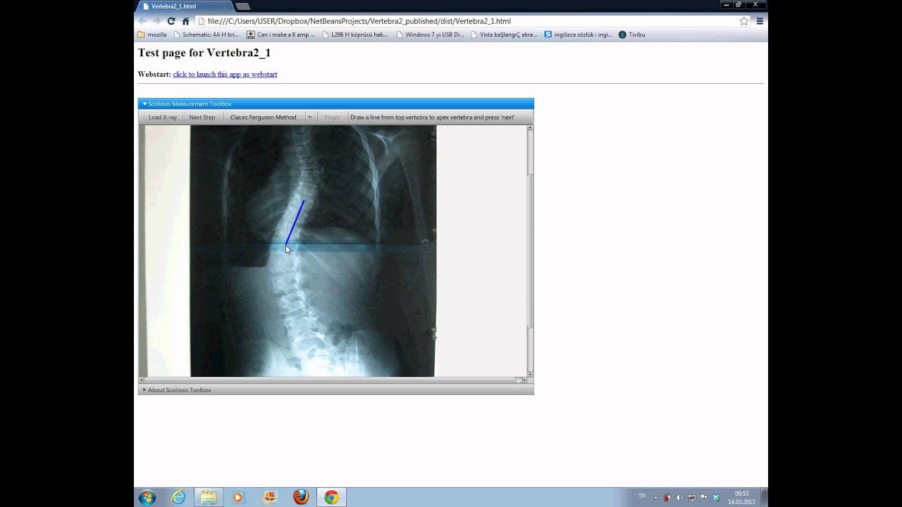 Ferguson Method - YouTube