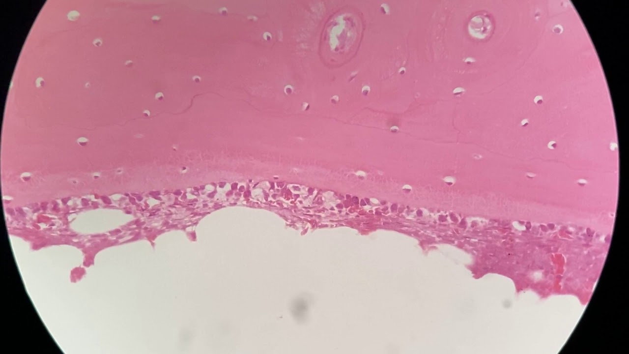 Osso compacto - YouTube