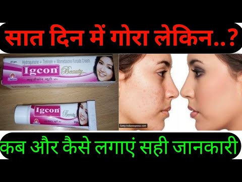 Igcon Beauty Cream Review | Igcon Beauty Cream Ko Kese Lagaye | Medical ...