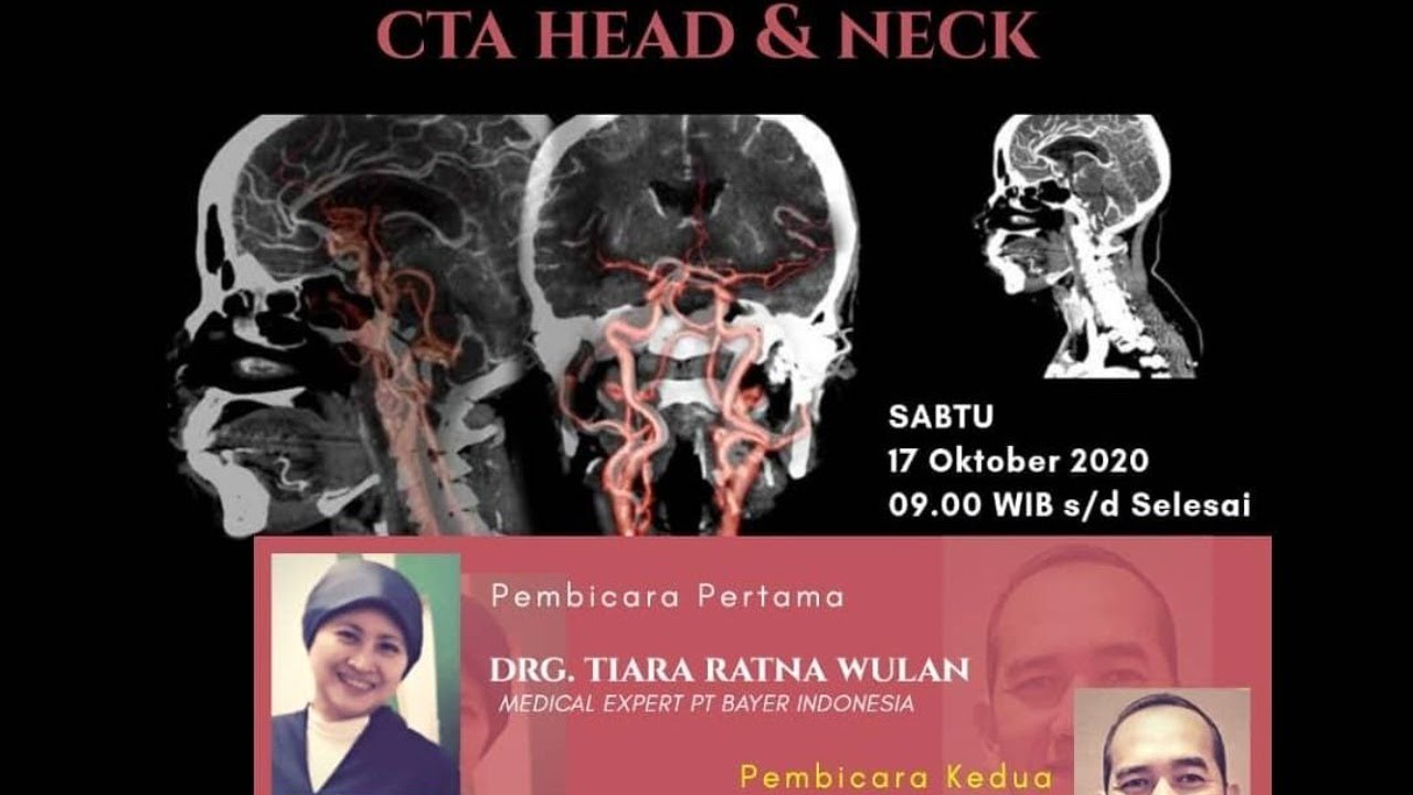 [Sesi 2 Webinar CT Scan] Webinar Radiografer Indonesia, Optimalisasi Protocol CTA Head & Neck ...