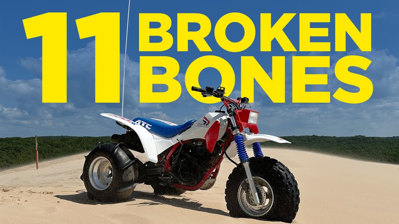 My 3-Wheeler Injury/Accident and Recovery Process - YouTube