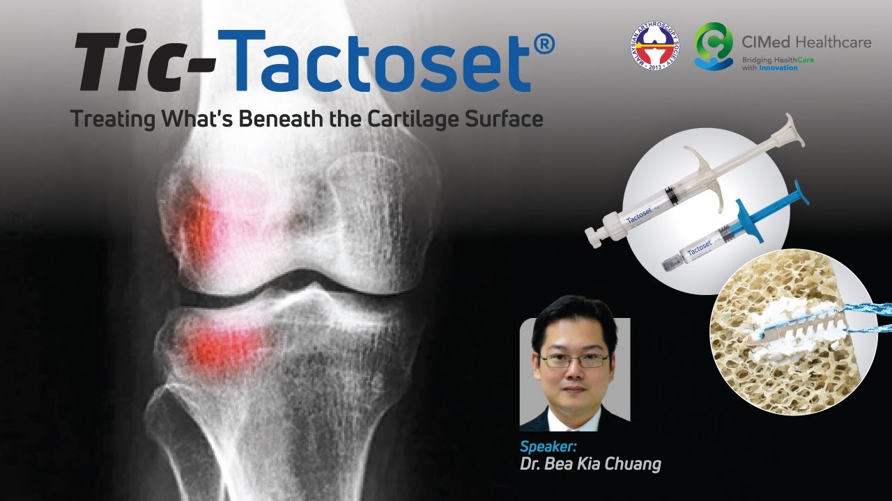Tactoset: Treating What’s Beneath the Cartilage Surface - YouTube