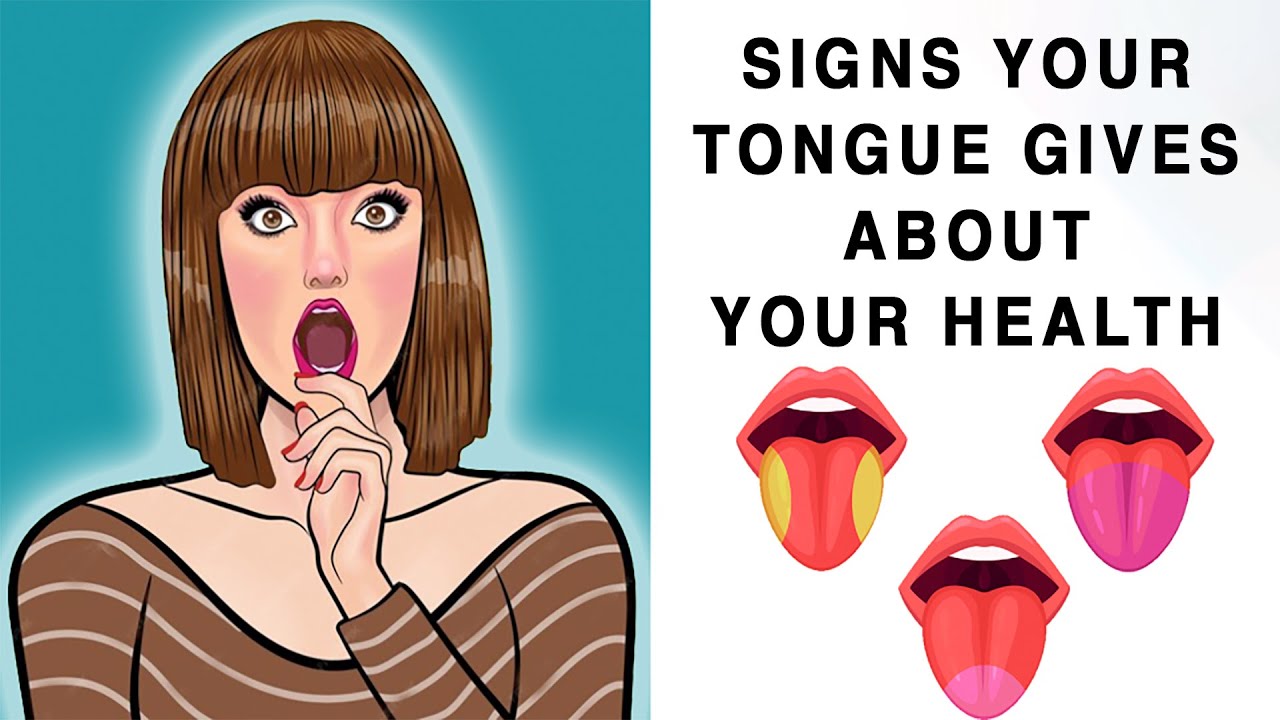 Signs Your Tongue Gives About Your Health - YouTube
