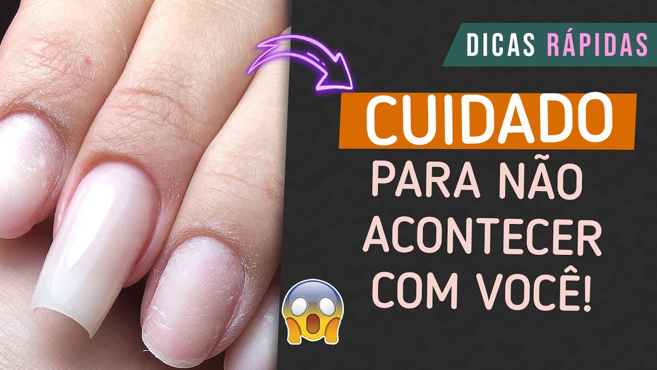 O QUE PODE CAUSAR DESCOLAMENTO DA UNHA NATURAL? l DICAS RÁPIDAS - YouTube
