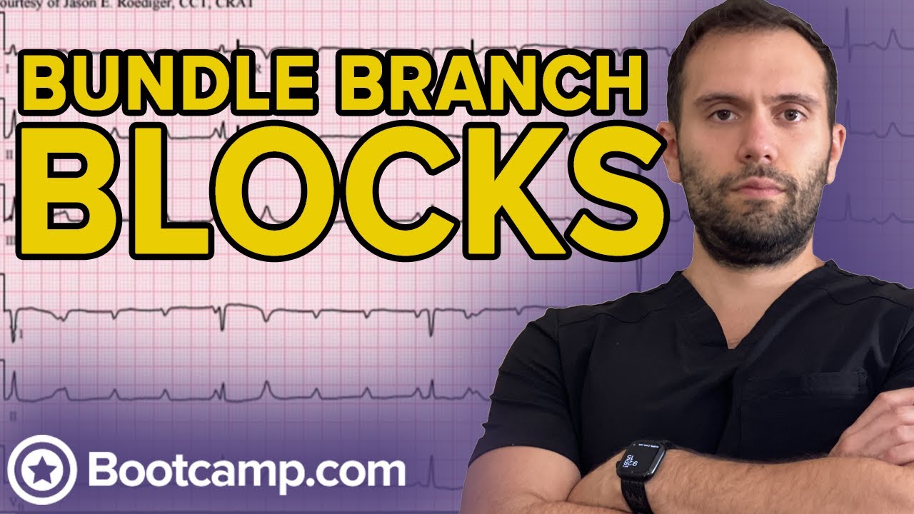 Conduction Blocks - Bundle Branch Blocks | HIGH-YIELD CARDIOLOGY ...