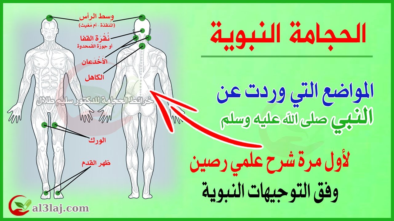 الحجامة النبوية المواضع التي احتجم عليها النبي الحجامة Youtube