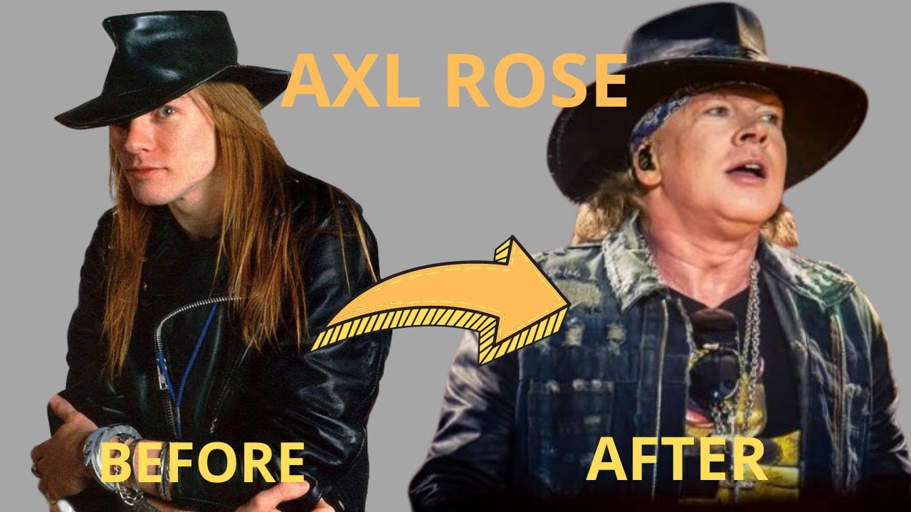 Axl rose Before and After - YouTube