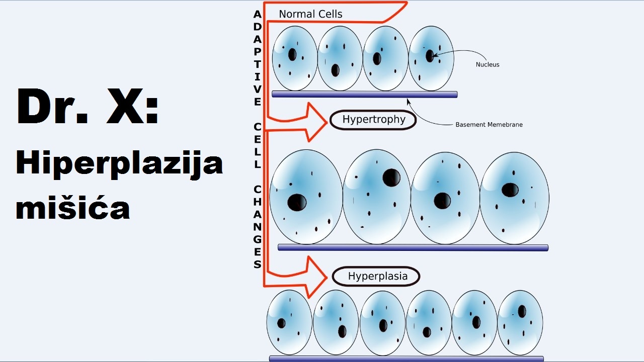 Dr X: Hiperplazija misica - YouTube