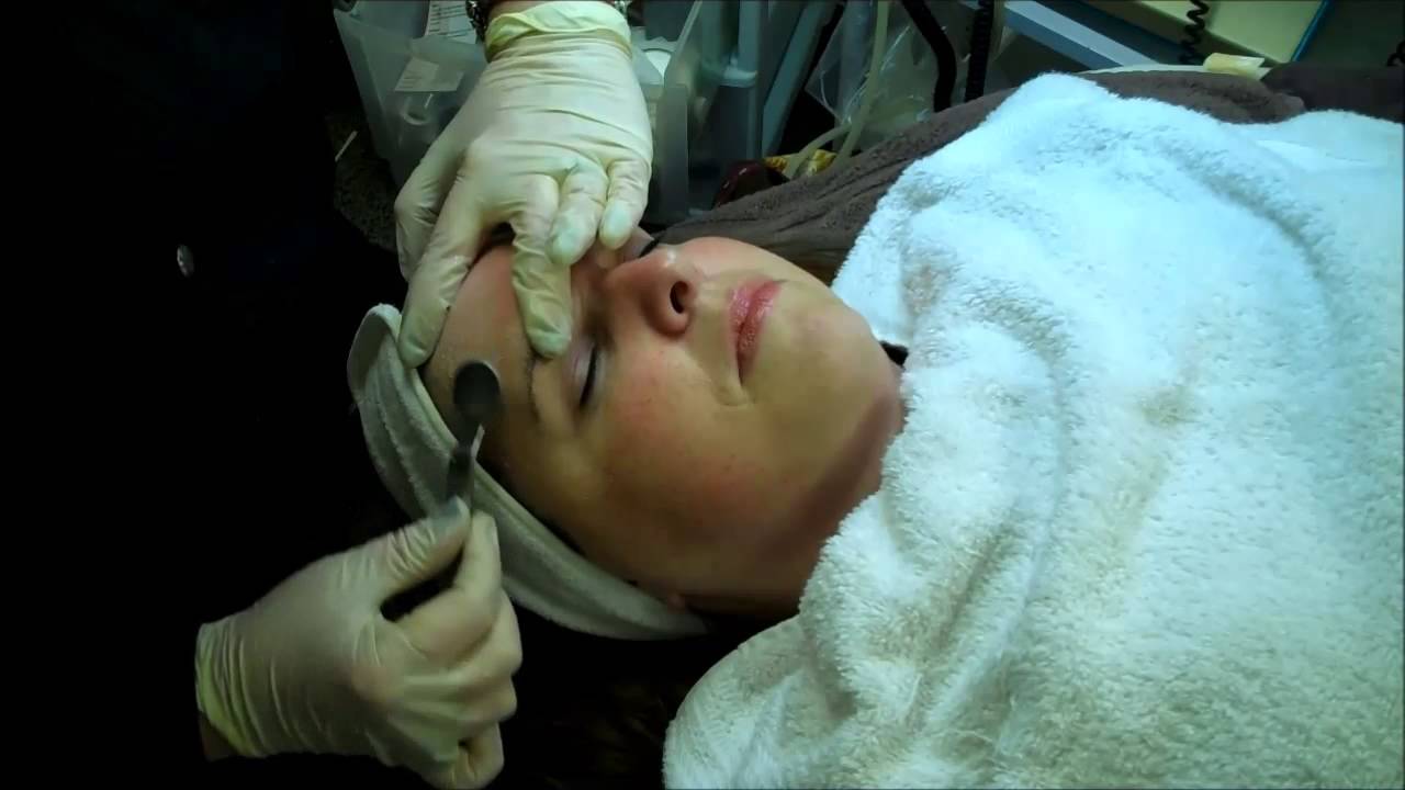 dermafiles - YouTube