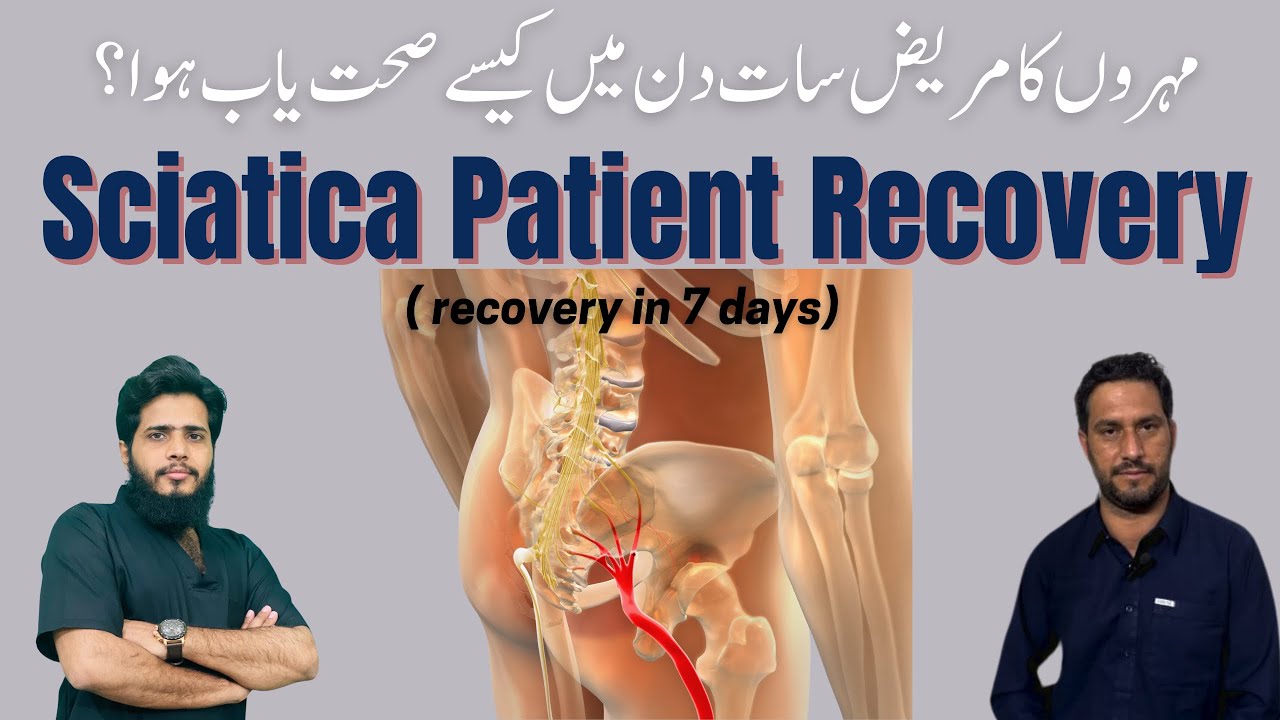 The Best Sciatica Pain Relief Exercises : sciatica patient quick recovery - YouTube