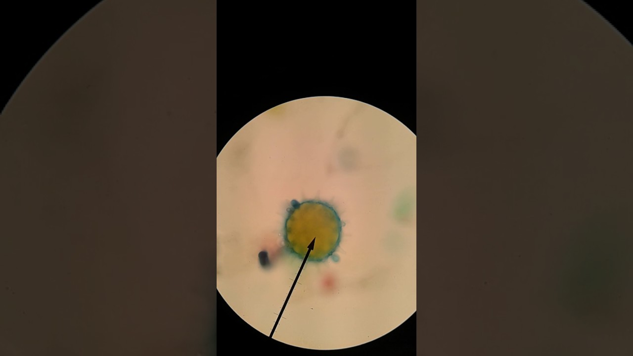 Pollen Spore at 1000x magnification - YouTube