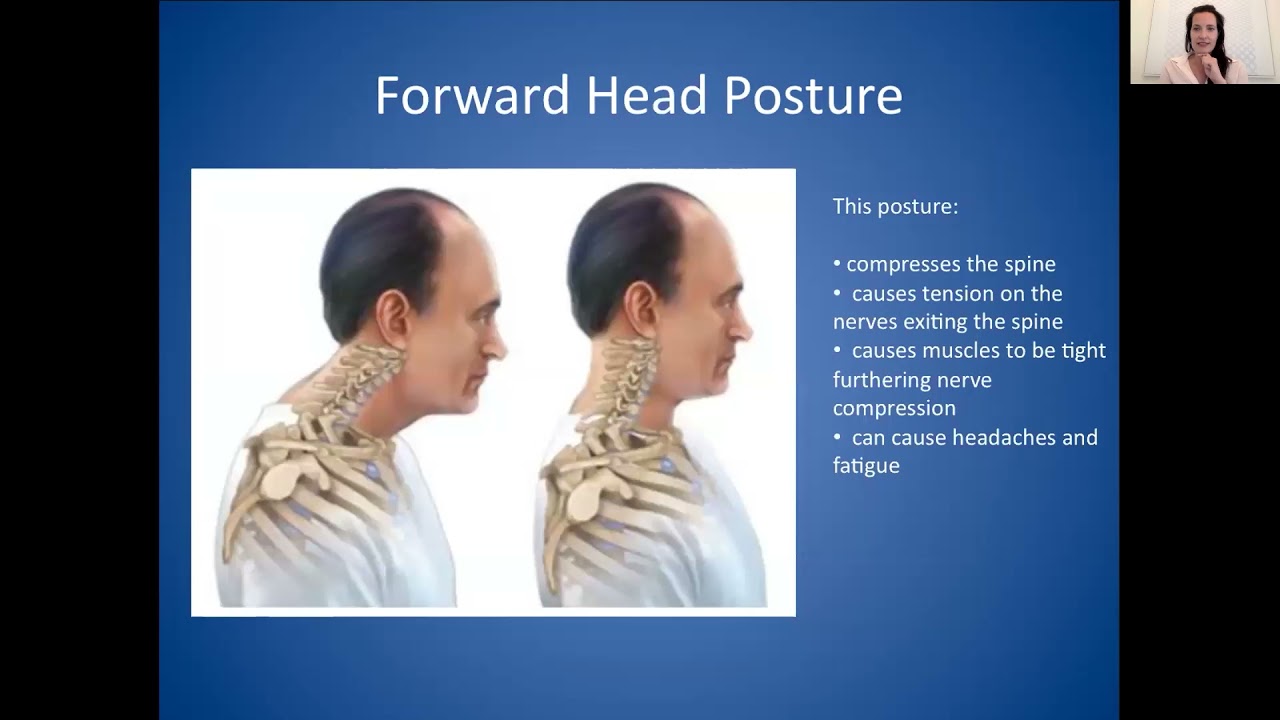 Chiari & Exercise Roundtable Part 2 - YouTube