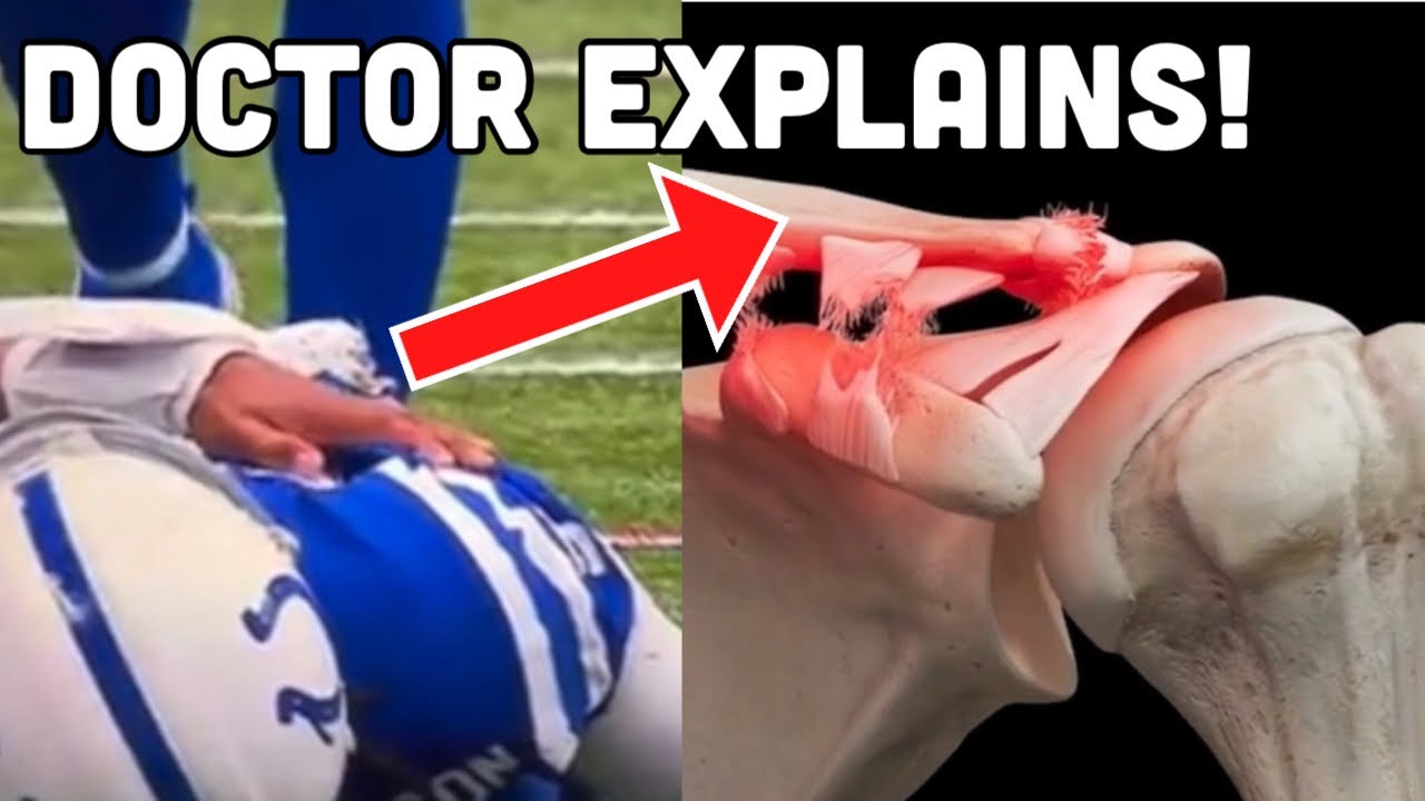 Anthony Richardson Grade 3 AC Injury | How BAD is it?? - YouTube