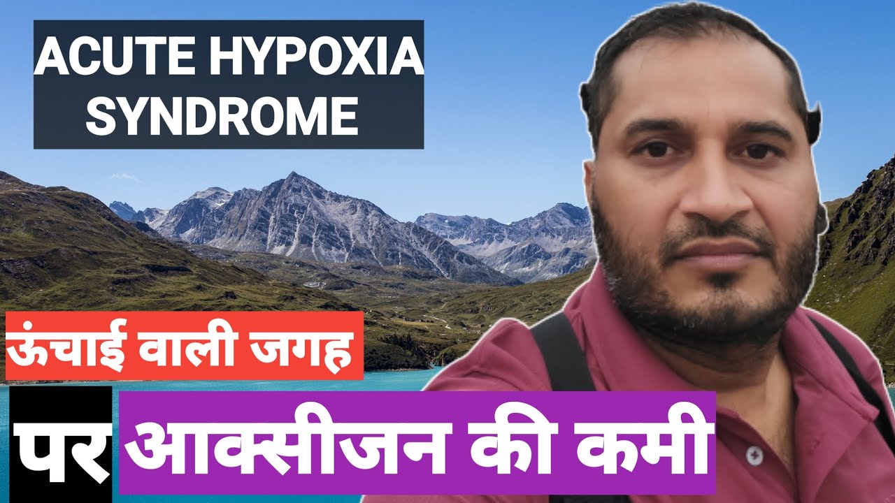 ACUTE HYPOXIA SYNDROME || HIGH ALTITUDE ILNESSES - YouTube