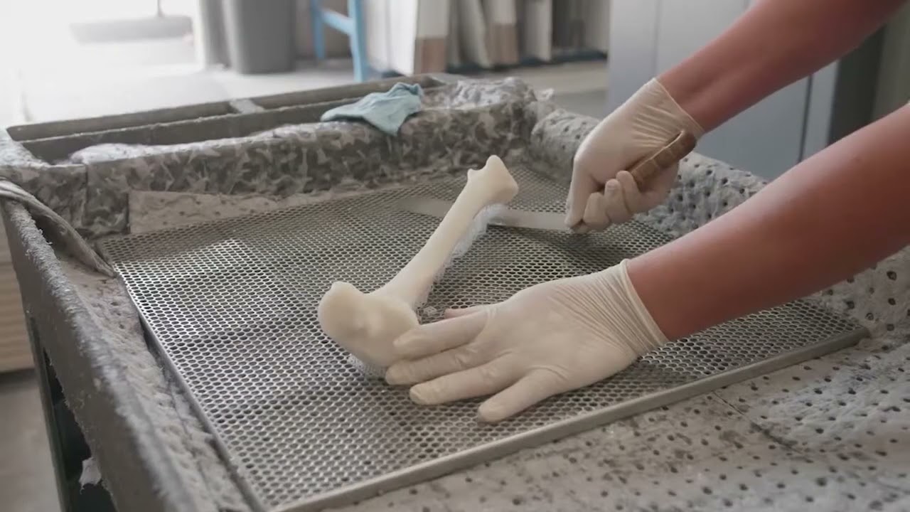 3D Printing Bones for Surgery Success - YouTube