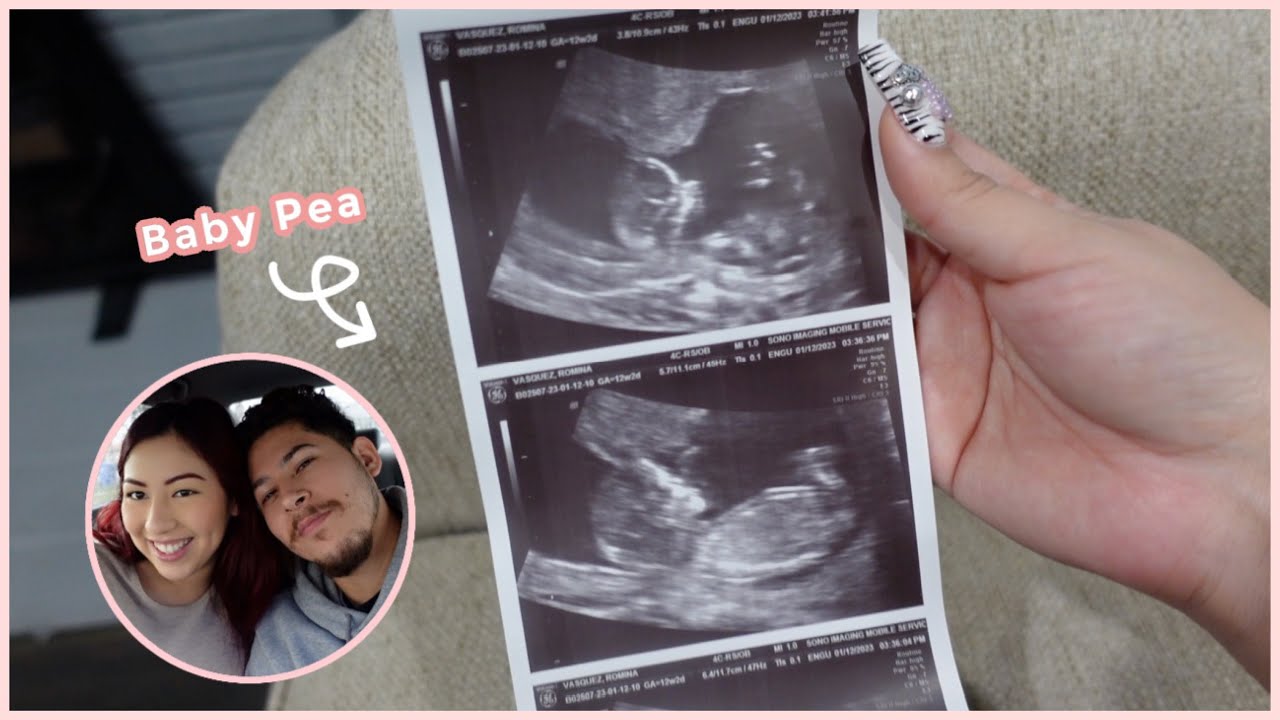 Finally seeing our baby!! 💓 | 12 Week NT Scan *VLOG* - YouTube