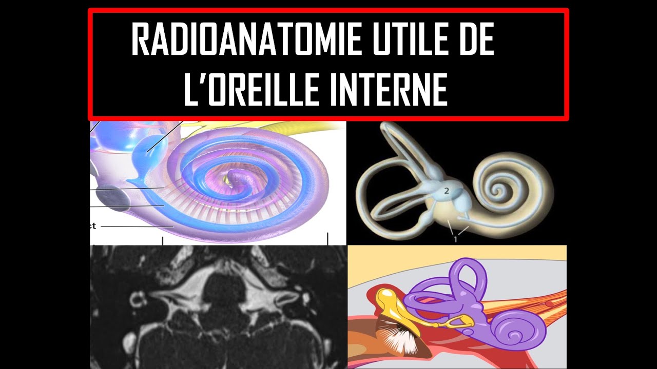 Radioanatomie utile de l'oreille interne - YouTube