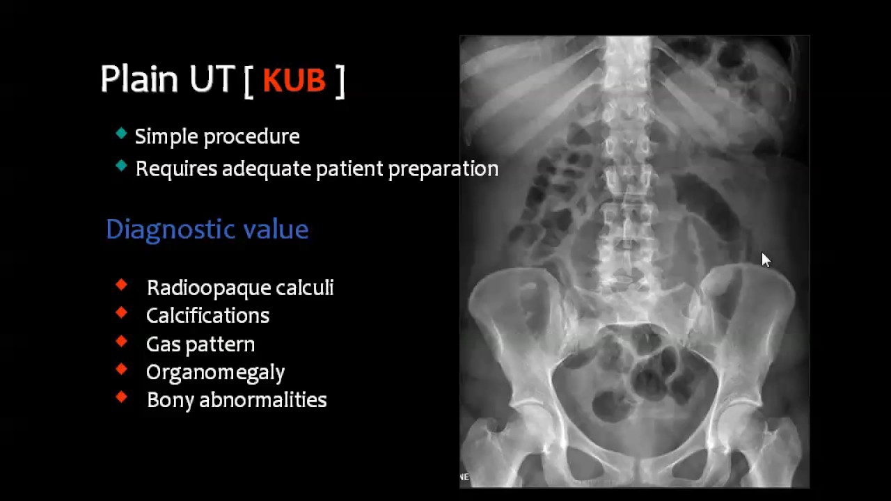 U.T Imaging Anatomy and Pathology - I - YouTube