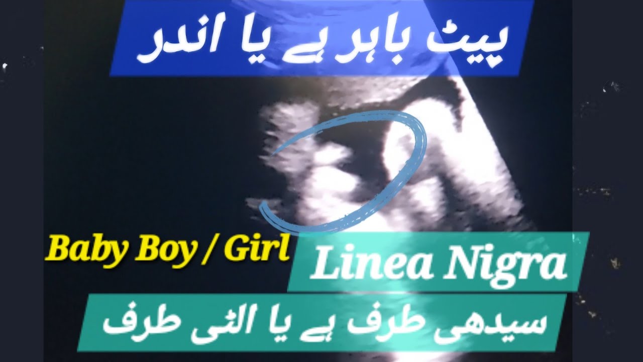It's a Baby Girl / Boy | Linea Nigra Can Reveal Gender| | GenderReveal ...