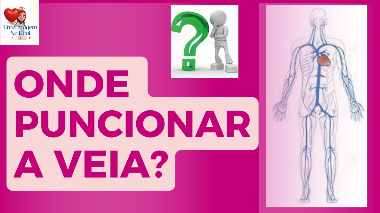 Onde puncionar? os melhores locais para acesso venoso periférico! - YouTube