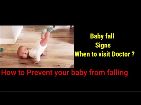 Baby fall | Baby falling from bed | Baby hit his head | Should visit a ...