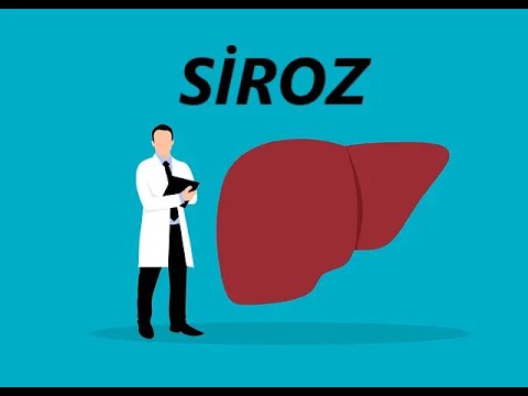 Siroz Hastalığı Nedir? (Siroz Nedir? Siroz Belirtileri Nelerdir? Siroz Tedavisi)