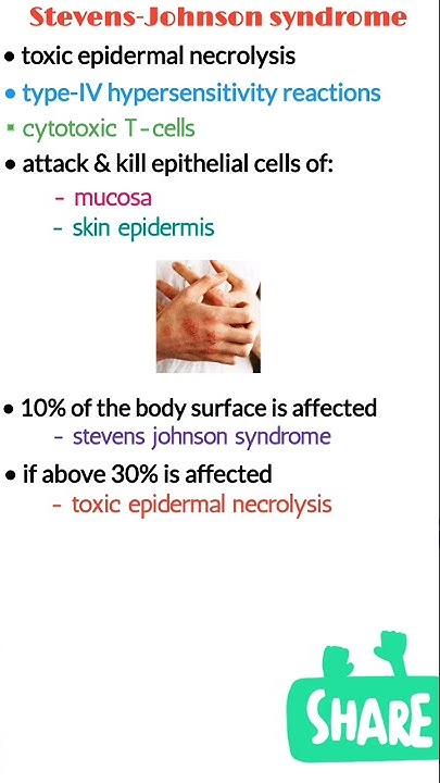 Steven johnson syndrome (SJS), symptoms, diagnosis, treatment, medical ...