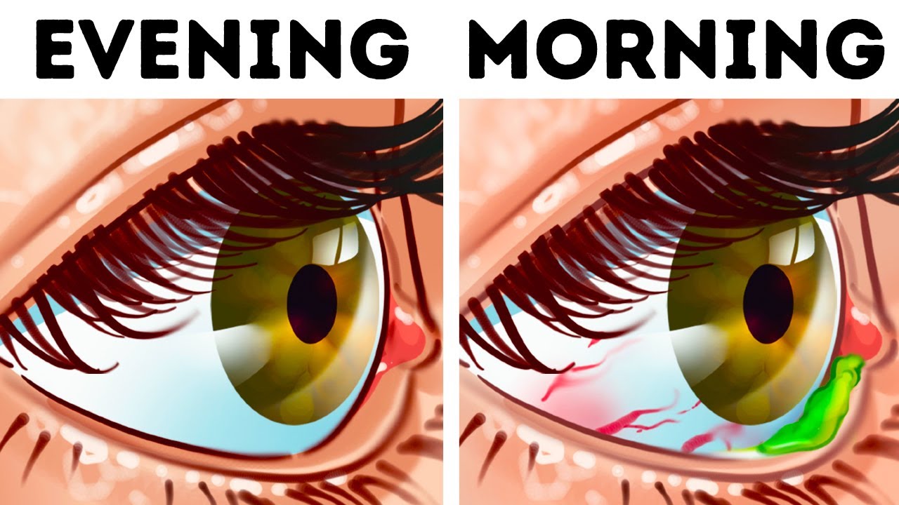 Why Your Eyes Get Crusty When You Sleep