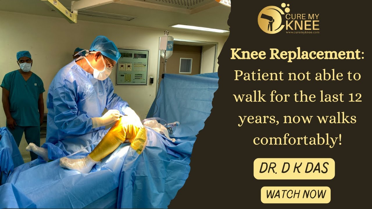 Knee Replacement Surgery Recovery by Dr DK Das @CureMyKnee # ...