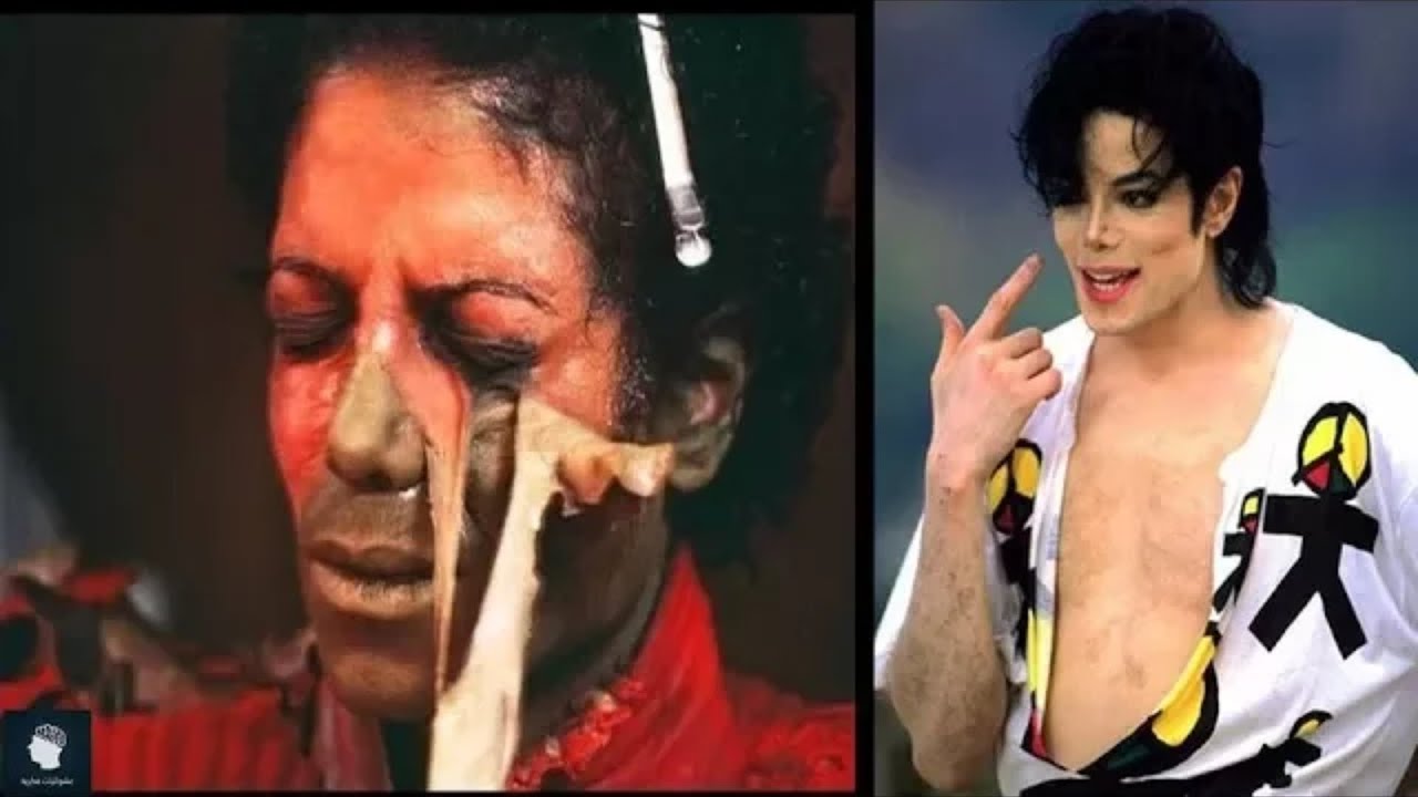 The Evolution Of Michael Jackson Face ( 0 To 50 Year ) - YouTube