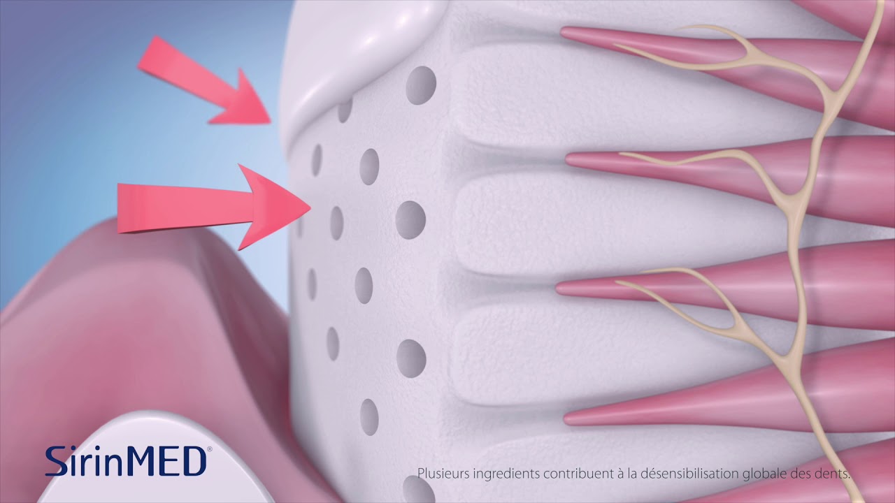 SirinMed French 15 R3 - YouTube