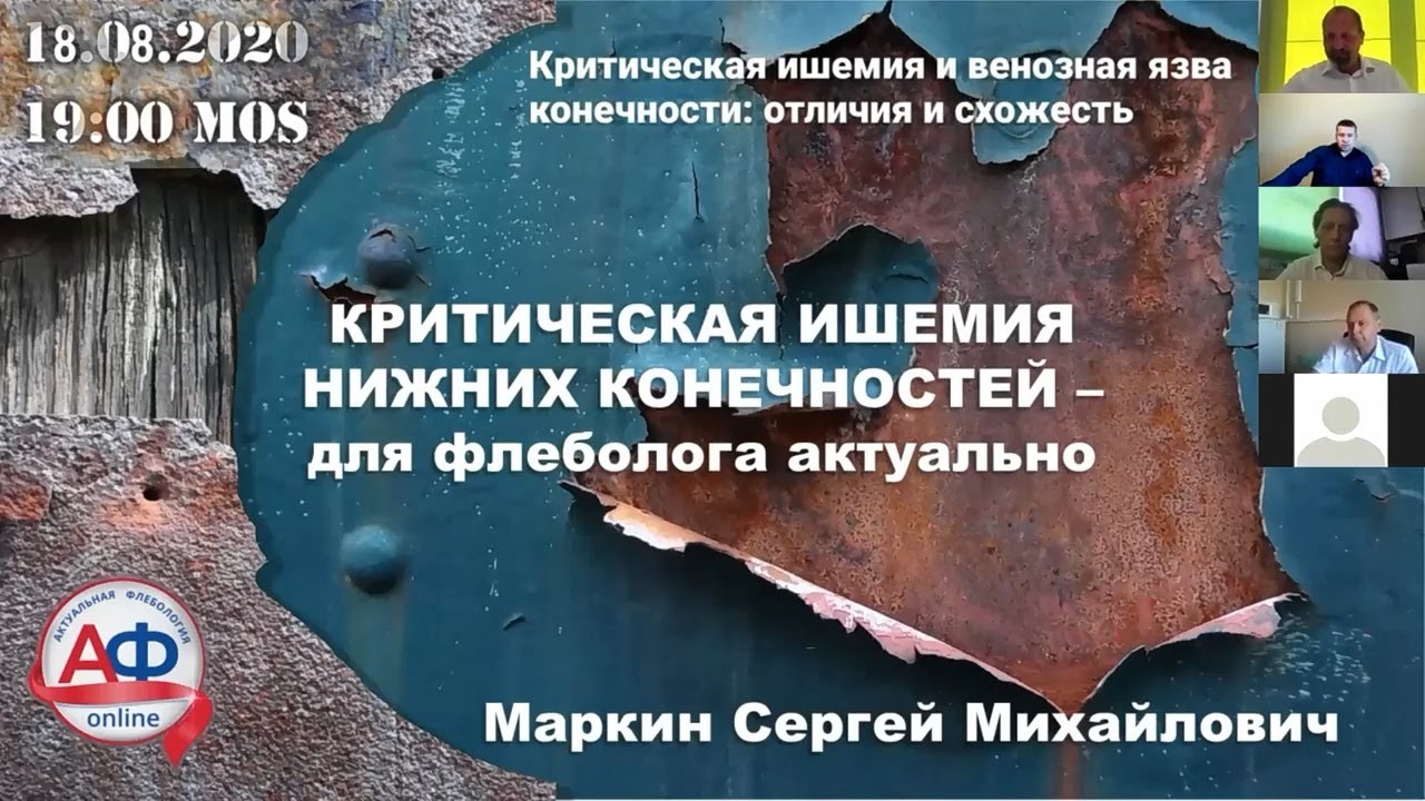 Критическая ишемия нижних конечностей для флеболога актуально Youtube