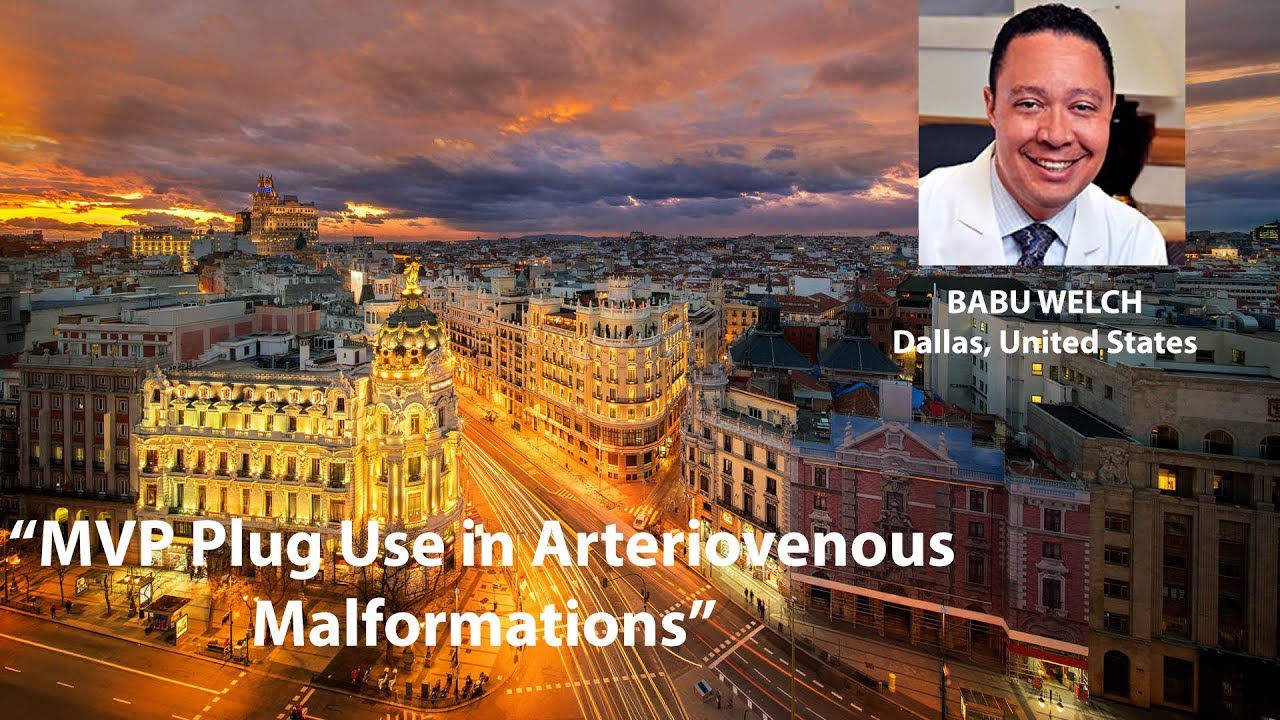 MVP Plug Use in Arteriovenous Malformations - YouTube