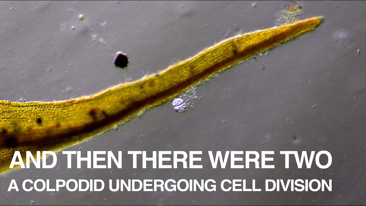 And Then There Were Two - A Colpodid Undergoing Cell Division - YouTube